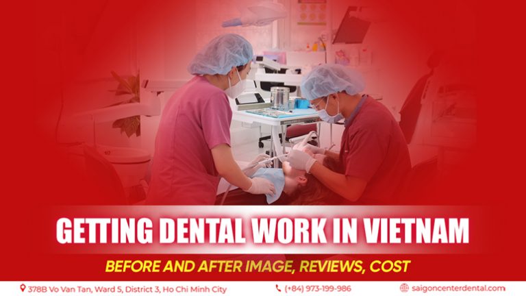 Getting Dental Work In Vietnam: Before And After Image, Reviews, Cost ...