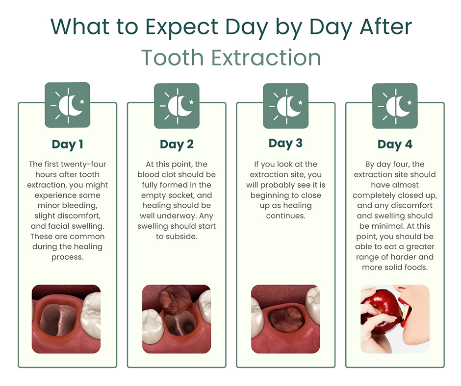 The Essential Guide To Healing Wisdom Tooth Extraction Saigon Center The Essential Guide To Healing Wisdom Tooth Extraction Saigon Center