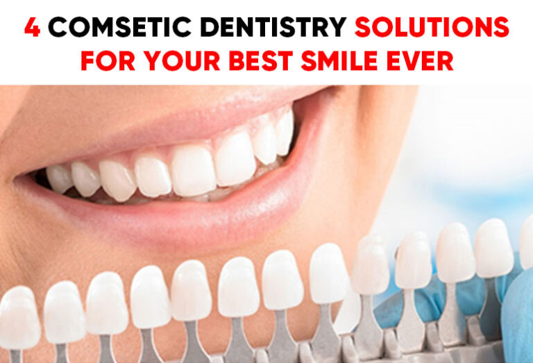 Understanding Tetracycline Teeth Staining - Saigon Center Dental Clinic