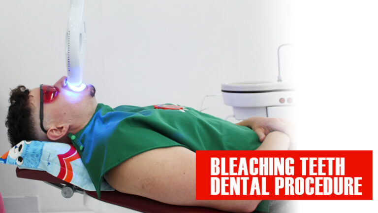 Bleaching Teeth Dental Procedure - Saigon Center Dental Clinic
